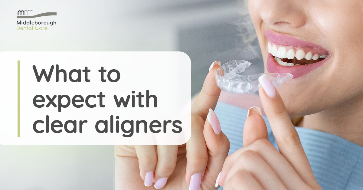 The journey to a straighter smile: What to expect with clear aligners ...